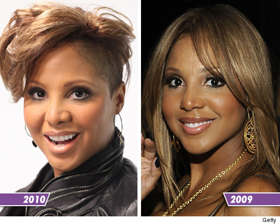 Toni Braxton Plastic Surgery